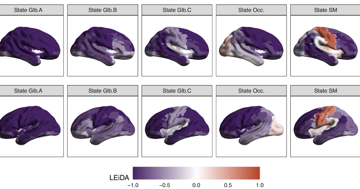 Patterns of brain connectivity differ between preterm and full term babies